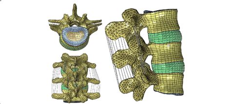 Finite Element Model Of Two Spinal Motion Segments L3 L5 Download Scientific Diagram