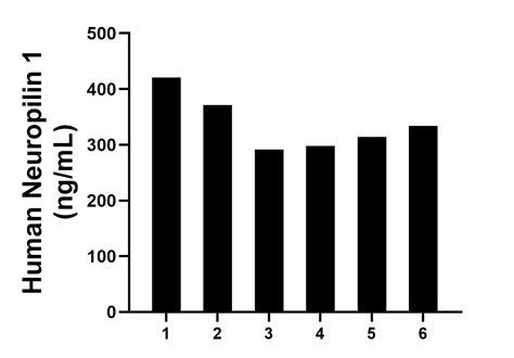 Neuropilin 1 Antibody 84429 4 Pbs Proteintech