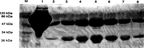 Anti Rabies Virus Monoclonal Antibody And Preparation Method And