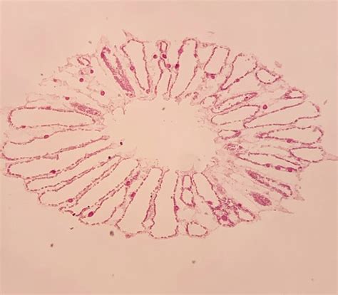 Final Lab Practical Microscope Slides Flashcards Quizlet