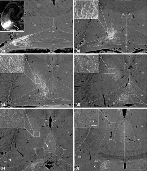 Development And Topographic Organization Of Subicular Projections To