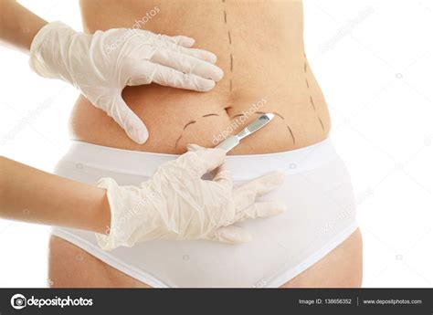 Surgeon Hands With Scalpel And Female Body Stock Photo Belchonock 138656352