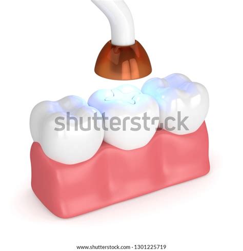 3d Render Teeth Dental Polymerization Lamp Stock Illustration