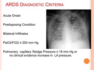 Acute Respiratory Distress Syndrome Ards PPTX