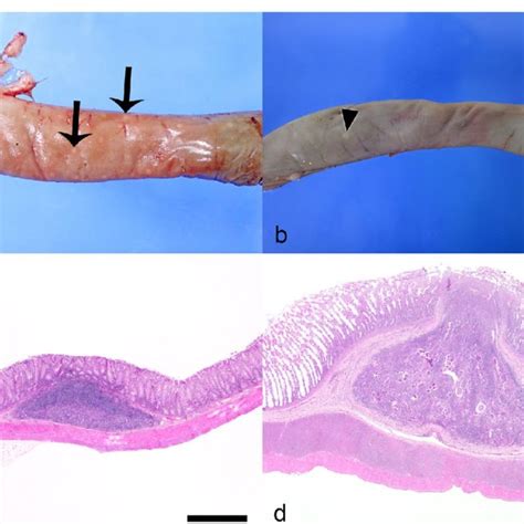Strongyloides Associated Colonic Nodules Cat A Mucosal Surface Colon