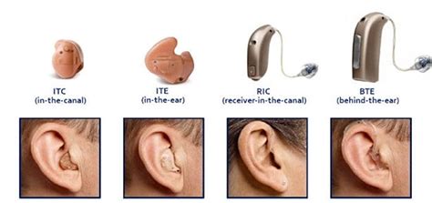 [2025 Update] What Is An Ite Hearing Aid The Complete Beginners Guid