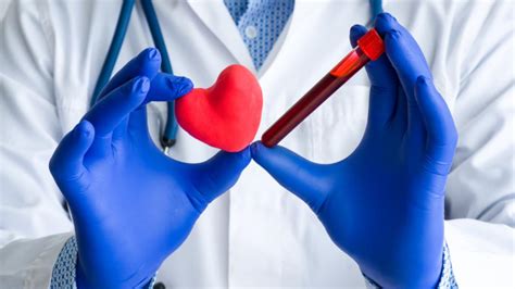 6 analize de sânge pentru evaluarea riscului de boală cardiovasculară