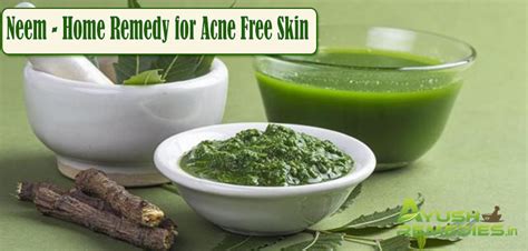 8 Home Remedies For Acne Free Skin For Smooth And Clear Skin