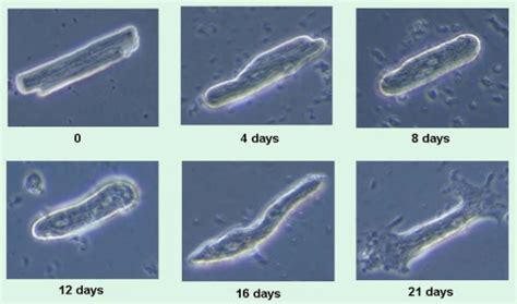 Ventricular Myocytes