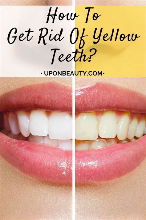 How To Get Rid Of Yellow Teeth Up On Beauty How To Turn Yellow
