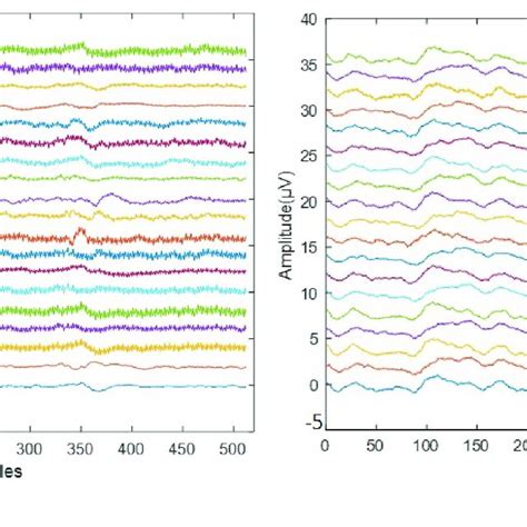 Summary Of The Works Done Automated Adhd Detection Using Eeg Signals