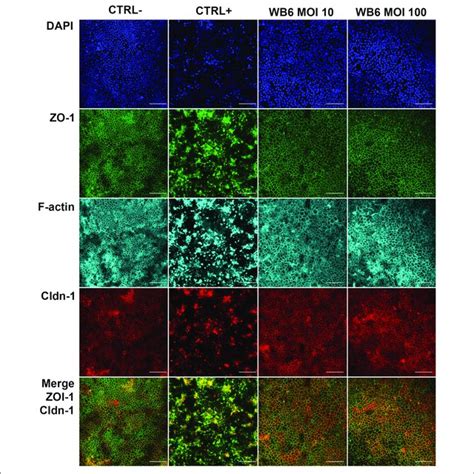 Tight Junction Integrity Micrographs Depict Tight Junction Proteins