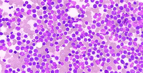 Vision Langauge Models Vlm In Medicine A Review By Abdulkader