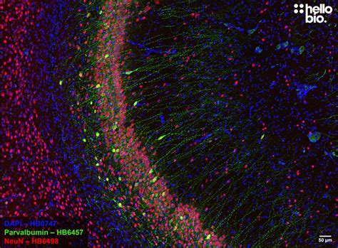 Anti Neun Antibody Validab™ Neuronal Marker Rabbit Polyclonal