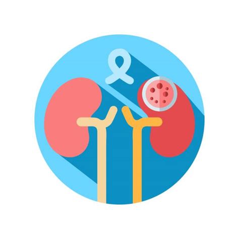 Renal Dysfunction Illustrations Royalty Free Vector Graphics And Clip