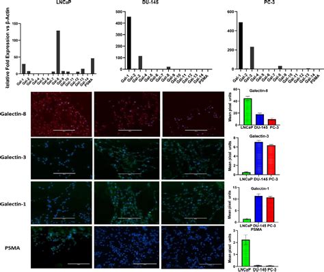 Figure 4 From Use Of GlycoproteinsProstate Specific Membrane Antigen