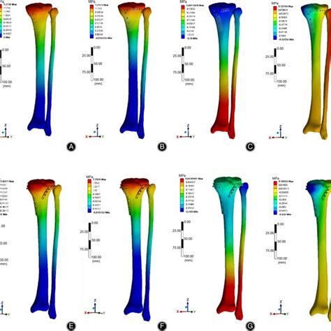 Displacement Distribution Of The Two Fixation Models A Overall