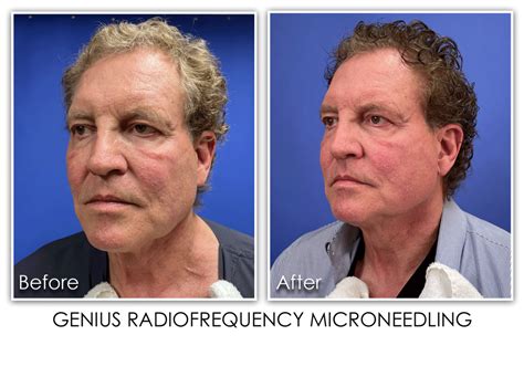 Galleries Archive Skin Rejuvenation Clinic Skin Rejuvenation Clinic
