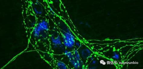 免疫荧光技术——直接法 学习中心 重庆宣尊生物科技有限公司 宣尊生物