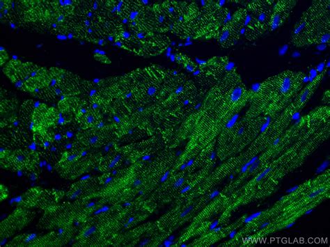Desmin Antibody 16520 1 Ap Proteintech
