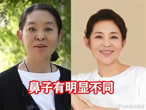 倪萍暴瘦后体重反弹，鼻孔外翻被质疑整容，看上去怪怪的