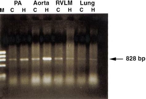 Rt Pcr Amplification Of Heme Oxygenase 2 In Pulmonary Artery Pa