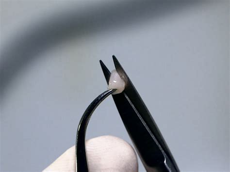 Video Urine Depletion And Bladder Rinsing In Mouse Model A Catheter