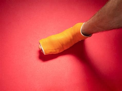 Premium Photo Foot With Broken Toe Bone In A Fiberglass Cast Pink