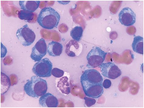 Plasma Cells