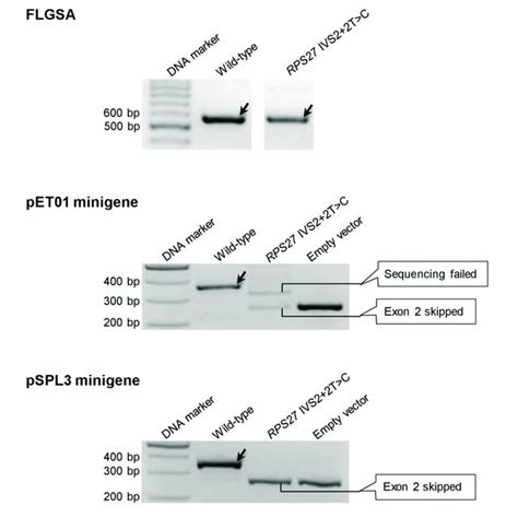 Schematic Illustrations Of The Minigene Expression Constructs In The
