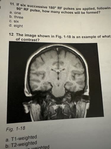Fundamentals Of Mri Flashcards Quizlet