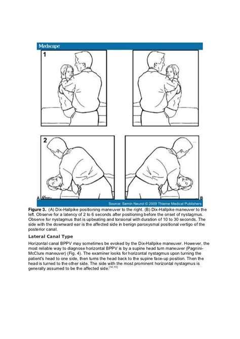 Bppv