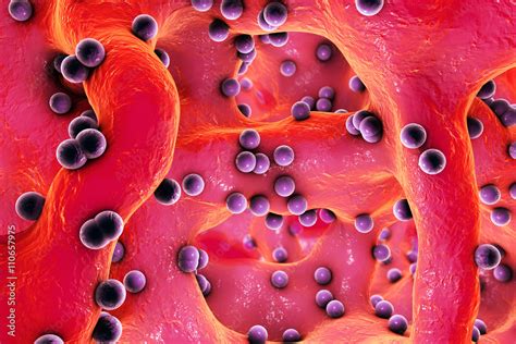 Spherical Bacteria Inside Bone Tissue Model Of Staphylococcus And