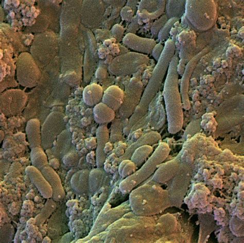 Earth May Be Home To A Trillion Species Of Microbes The New York Times