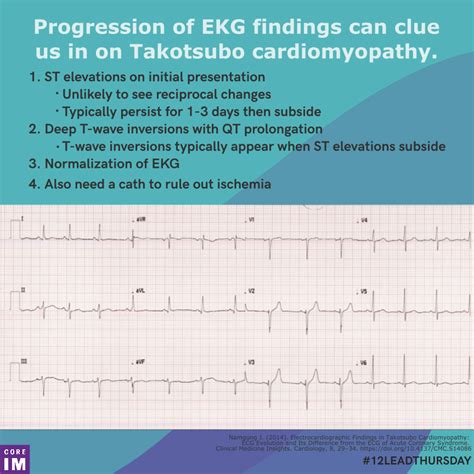 Takotsubo Cardiomyopathy Core Im Podcast