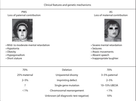 Mayo Clinic Angelman Syndrome Clinic Angelman Syndrome