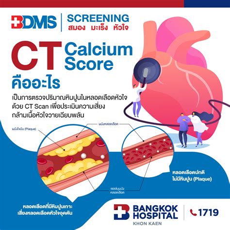 Ct Calcium Score โรงพยาบาลกรุงเทพขอนแก่น