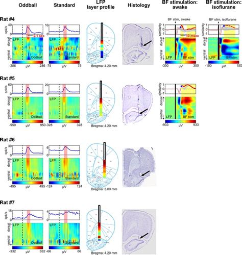 Figures And Data In A Frontal Cortex Event Related Potential Driven By