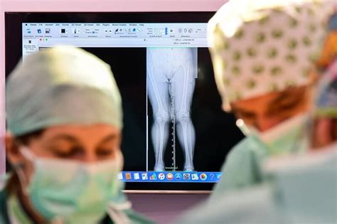 Osteotomy Of The Knee