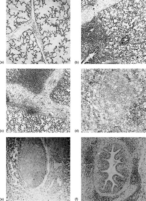 Histological Detail Of Lung Tissues Showing A Normal Lung Tissue Of