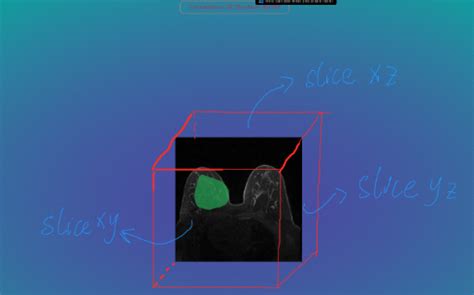 7 Documentation For Store Mask Data And Transfer Function In NRRD