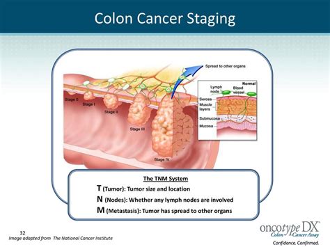 Pre Op Antibiotics Colon Surgery