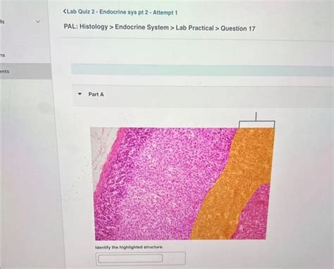 Solved Identify The Highlighted Structure Identify The