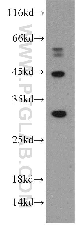 Mmadhc Antibody 23191 1 Ap Proteintech