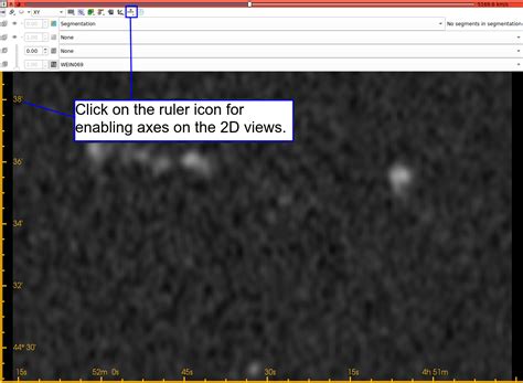 Documentation Nightly Modules Astrovolume Slicer Wiki