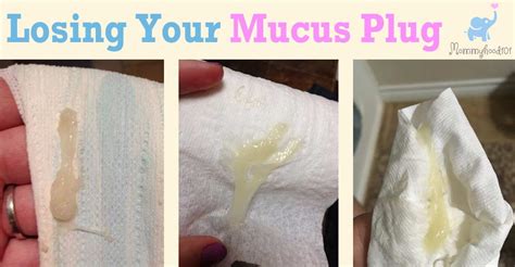 What Does A Mucus Plug Look Like At Josephine Blumberg Blog
