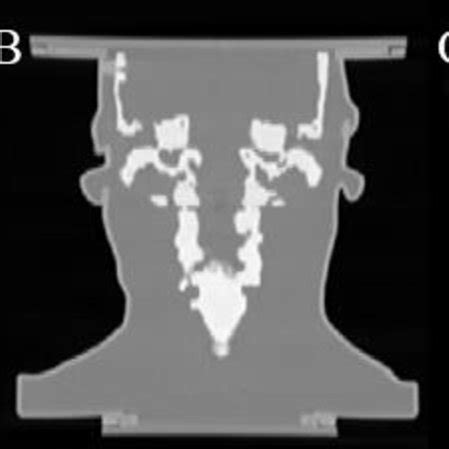 CT Scan Of Phantom Showing A Axial B Coronal C Sagittal Views Download Scientific