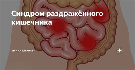 Синдром раздражённого кишечника Ирина Баранова Первая Школа
