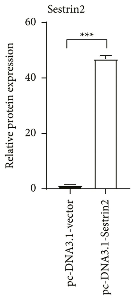 Sestrin2 Overexpression Ameliorates Tm Induced Er Stress A