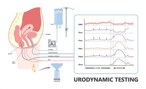 Urodynamic Testing Procedure